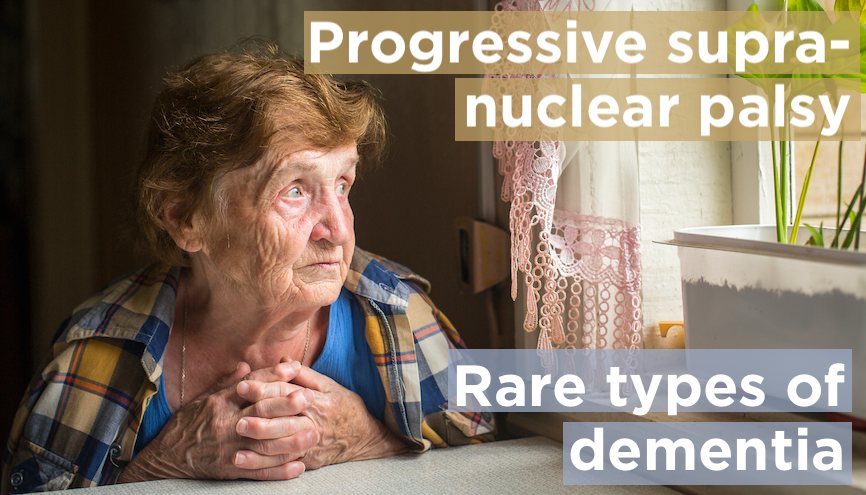 Progressive supranuclear palsy | Alzheimer Society of Canada
